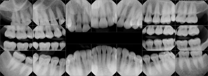 Jazz Solo Sensor - Jazz Imaging
