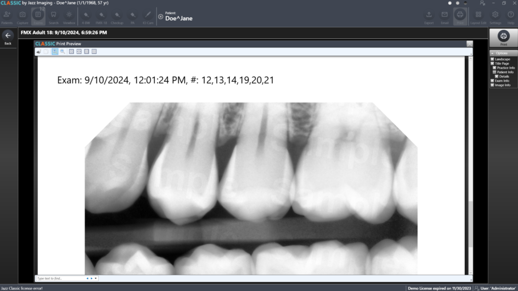 Jazz Classic Dental Imaging Software