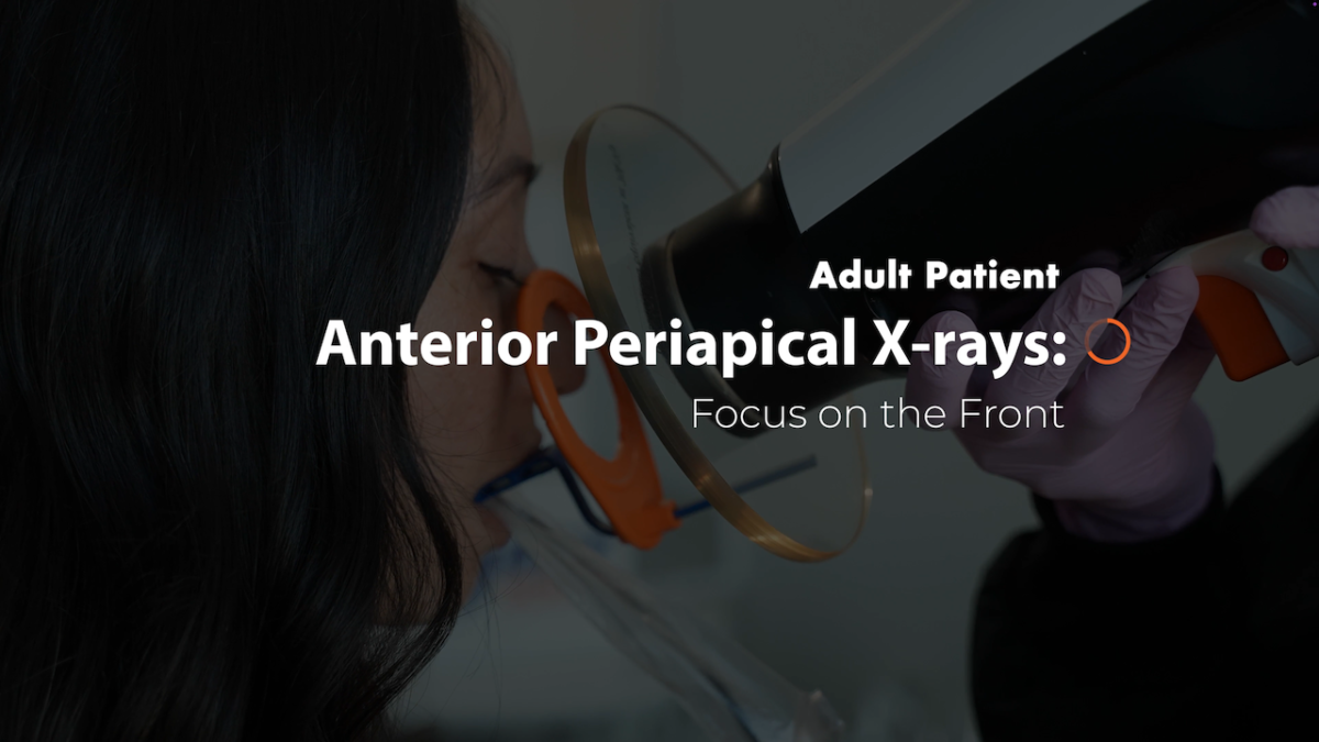 Adult Intraoral X-ray Positioning - Jazz Imaging